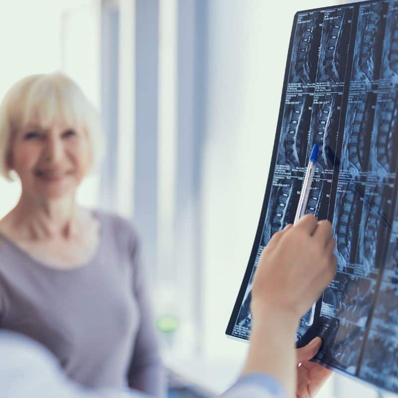 Kyphoplasty Treatment | Restore Vertebrae And Relieve Pain